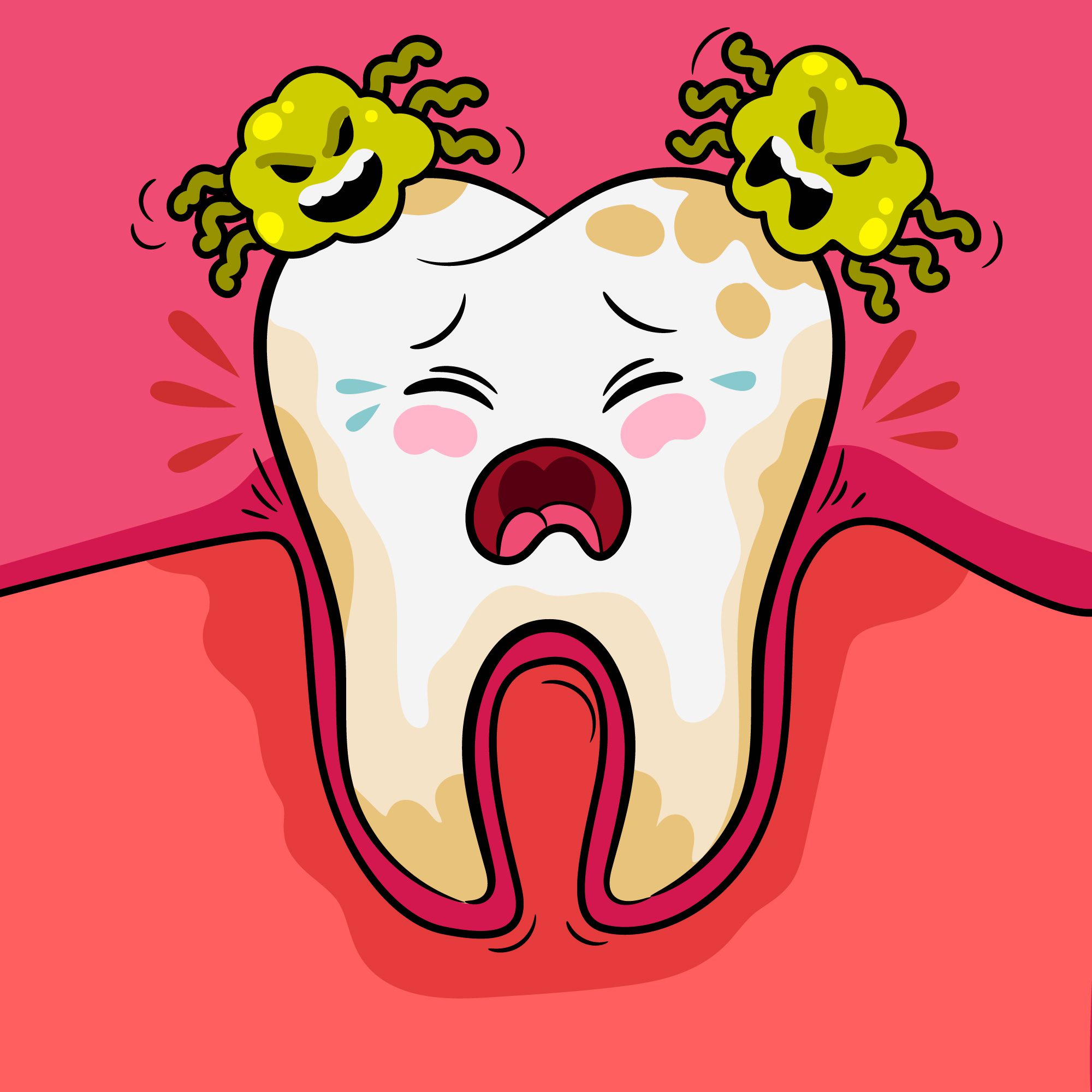 How Long Until A Tooth Infection Kills You?